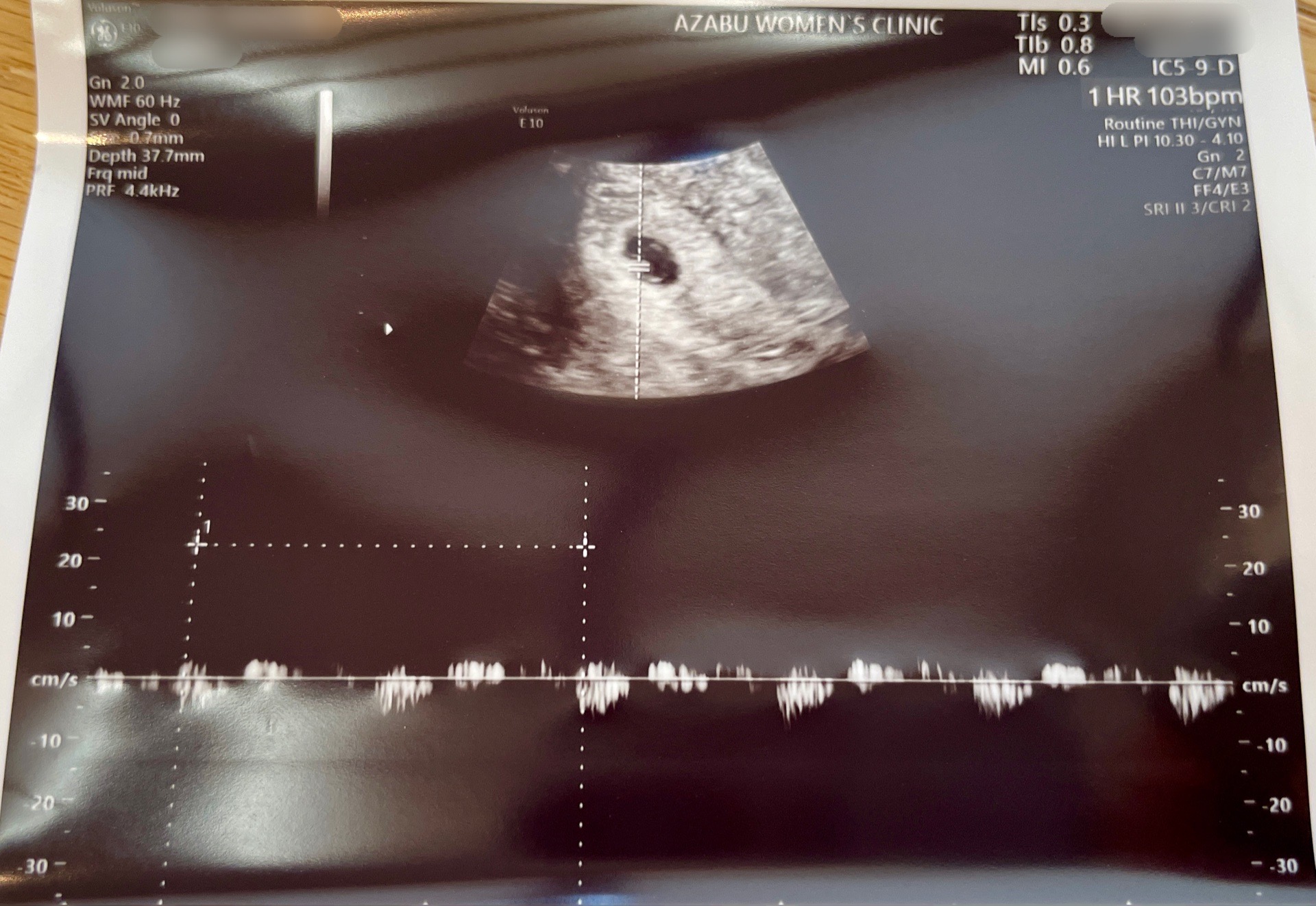 稽留流産（心拍確認後7w相当）した時のこと①【妊娠発覚～流産発覚】 | kanami blog