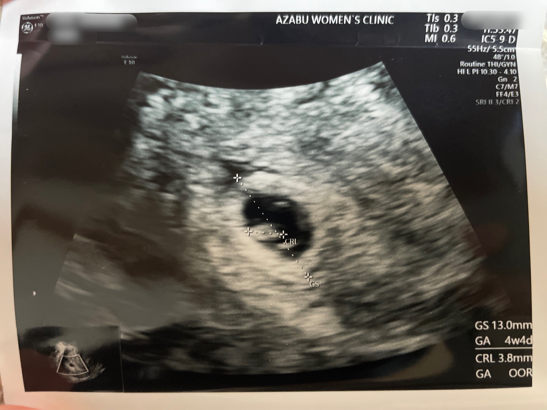 稽留流産（心拍確認後7w相当）した時のこと①【妊娠発覚～流産発覚】 | kanami blog